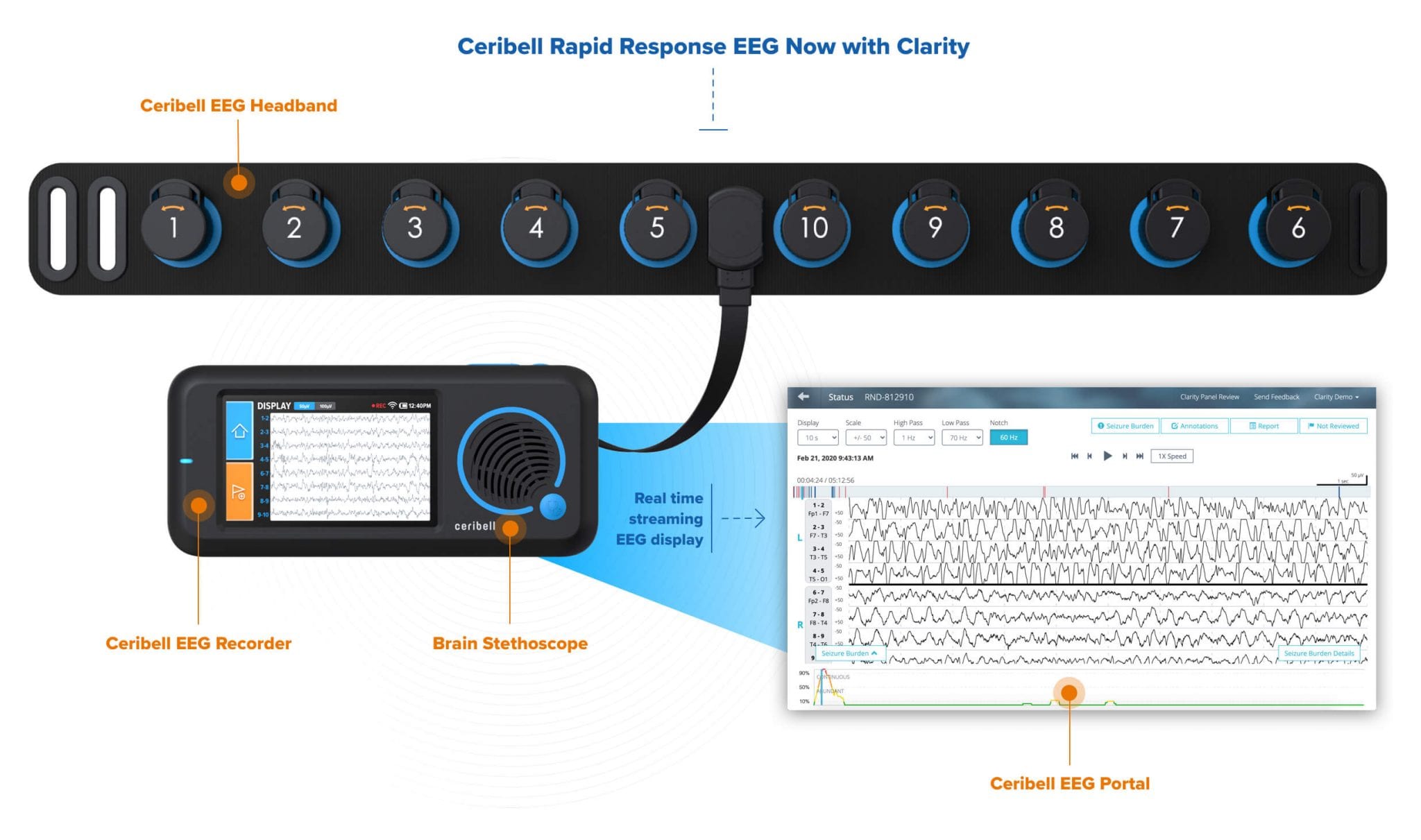 Ceribell EEG - FDA-cleared system to improve treatment of seizure patients