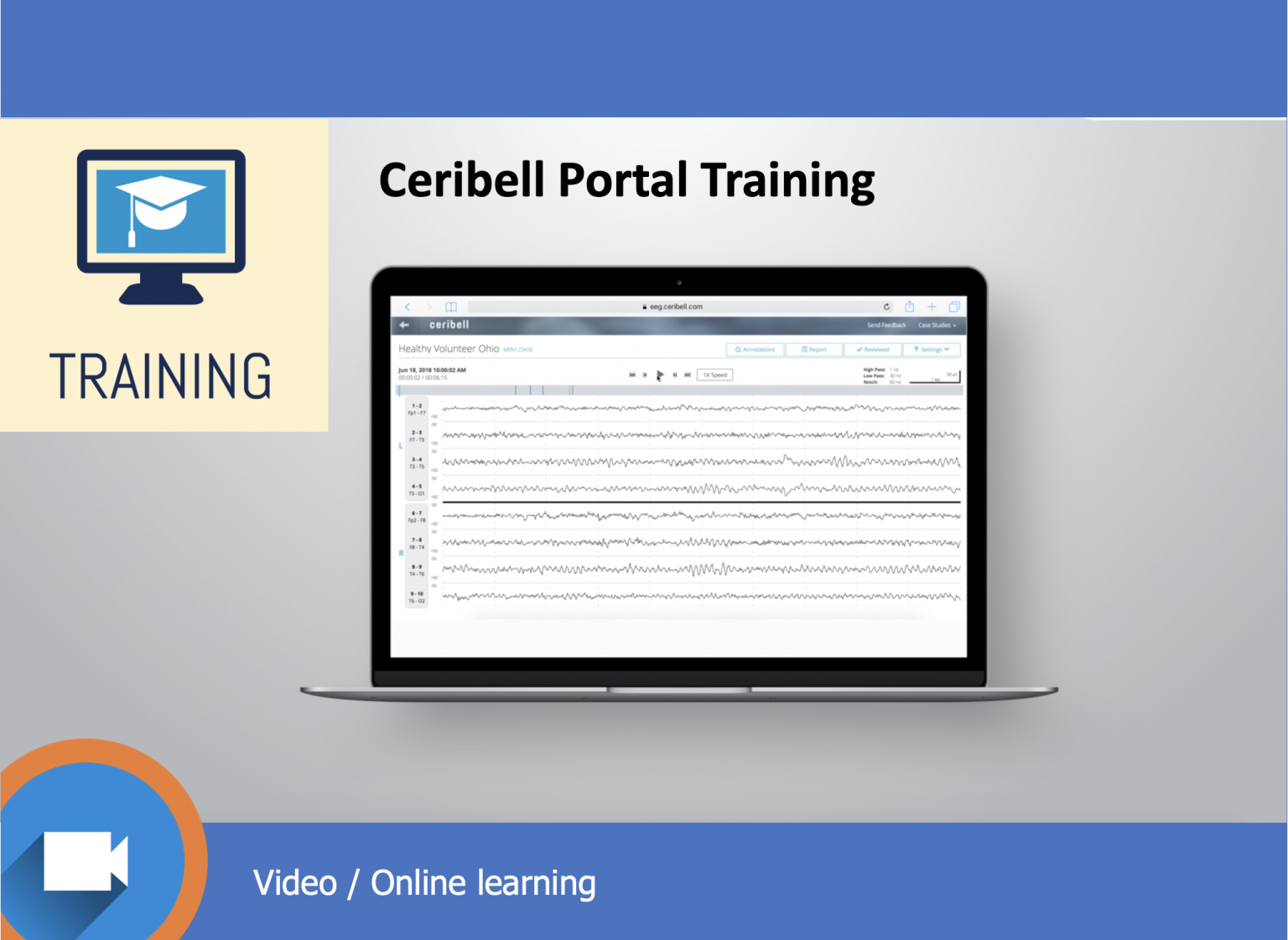 Ceribell System Setup Training - Ceribell
