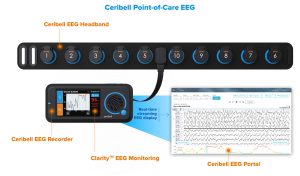 Ceribell EEG - rapid seizure triage for critical care