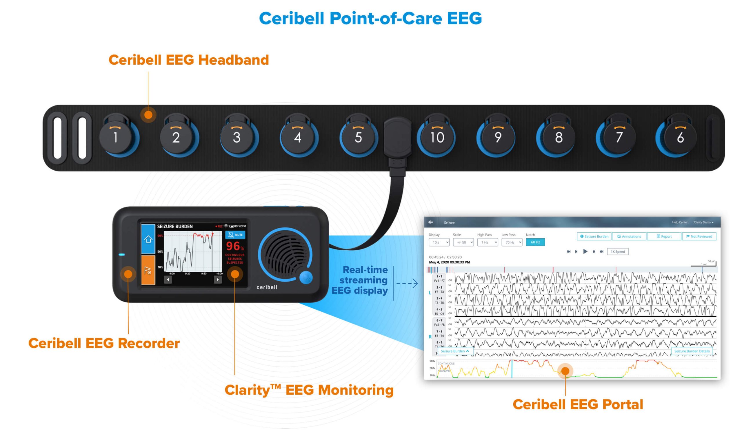 Ceribell EEG - rapid seizure triage for critical care