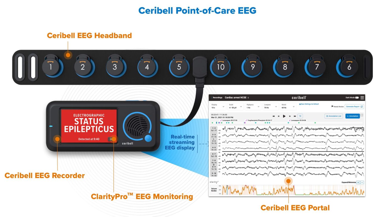 Ceribell EEG - rapid seizure triage for critical care