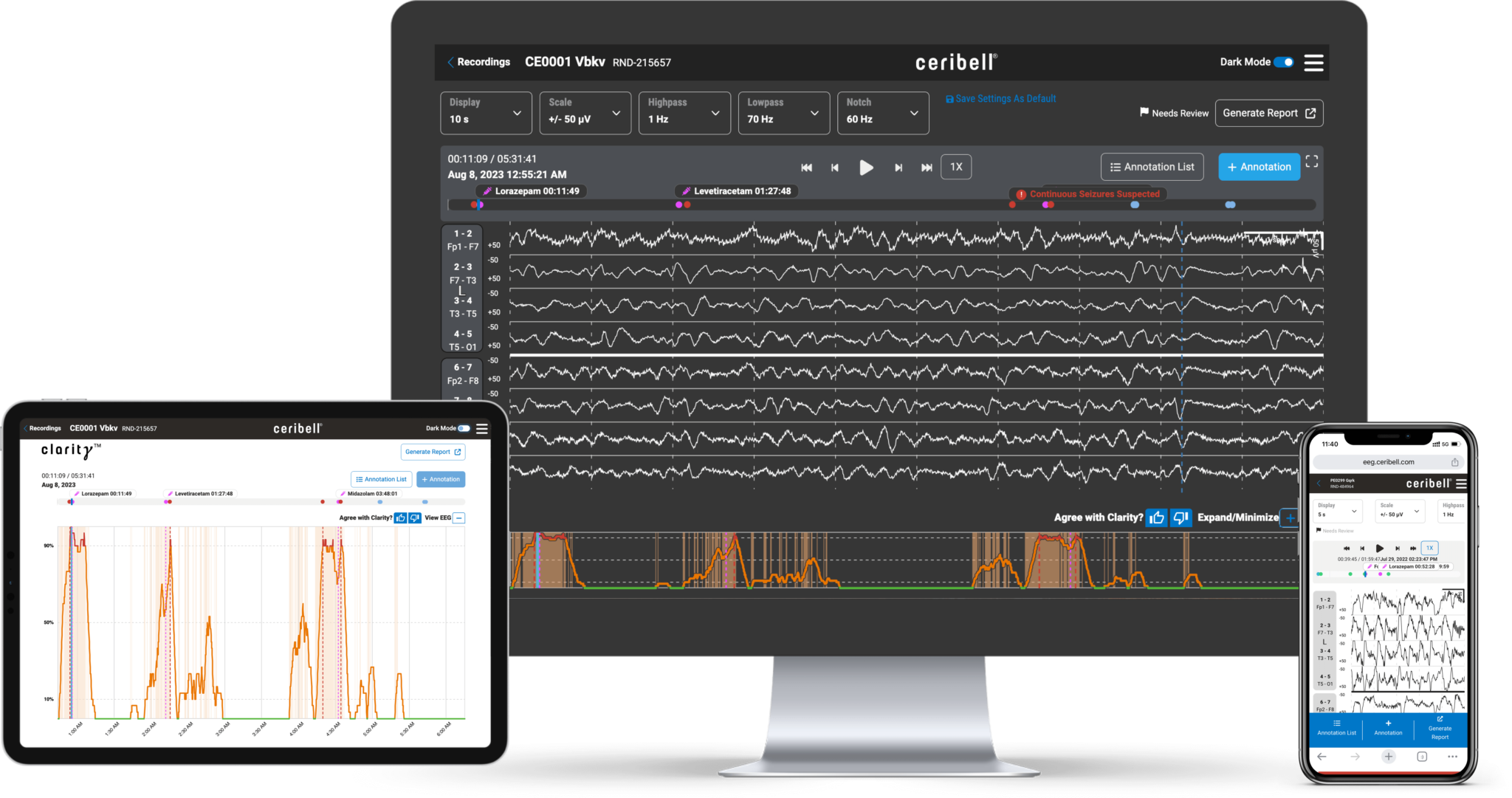Neurology | Ceribell