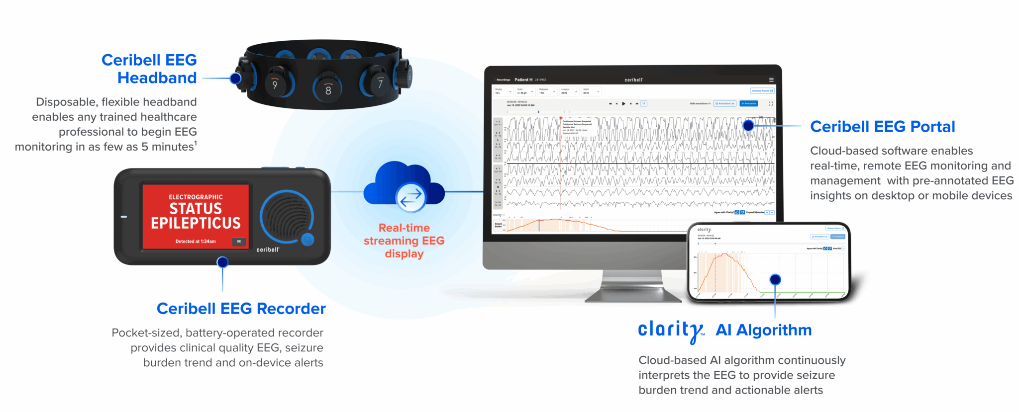 Point-of-Care EEG | Ceribell