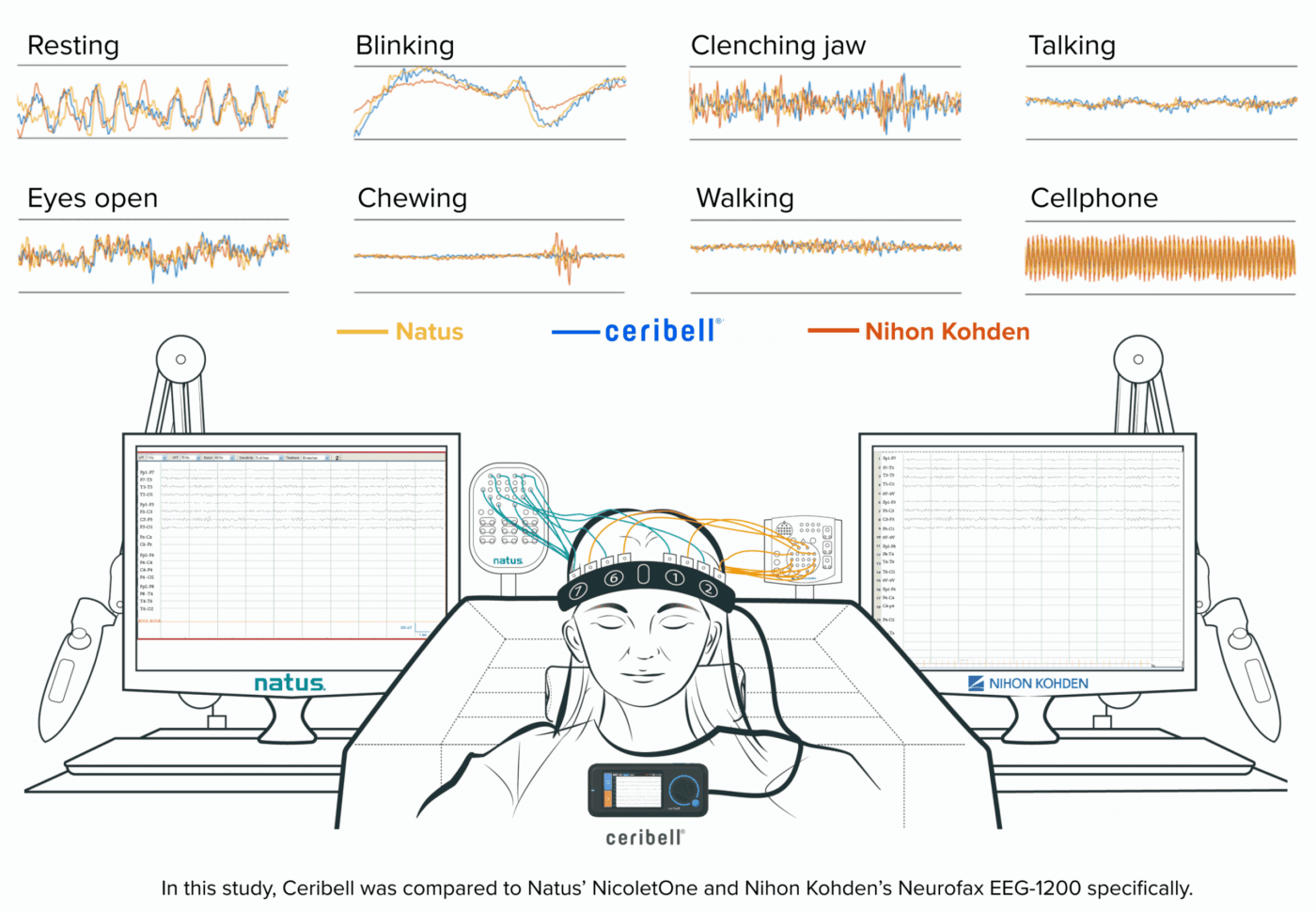 Ceribell for Neurology | Rapid EEG for Seizure Diagnosis & Monitoring