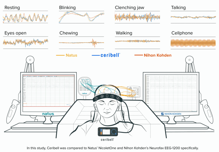 Ceribell for Neurology | Rapid EEG for Seizure Diagnosis & Monitoring