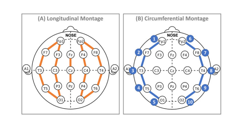 Ceribell for Neurology | Rapid EEG for Seizure Diagnosis & Monitoring
